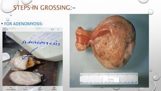 Histopath Grossing of uterus cervix &ovary | PPTX