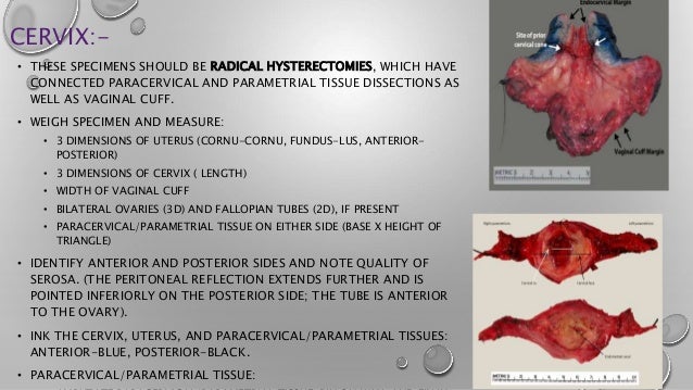 Histopath Grossing of uterus cervix &ovary