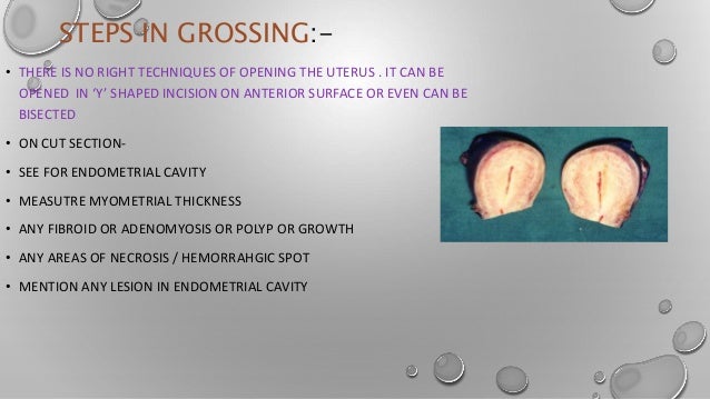 Histopath Grossing of uterus cervix &ovary