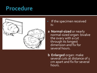 Grossing procedure for ovary | PPTX