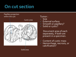 Grossing procedure for ovary | PPTX