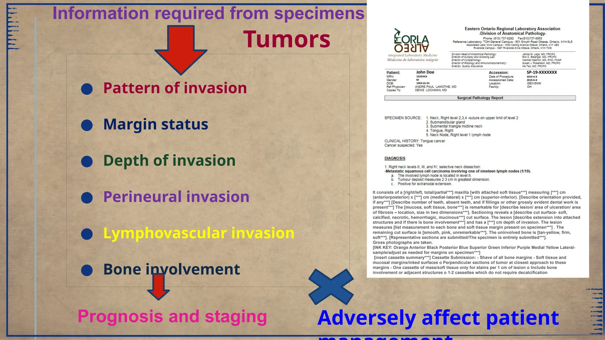 GROSSING PTNM journal club for MDS GRADUATES.... | PPTX