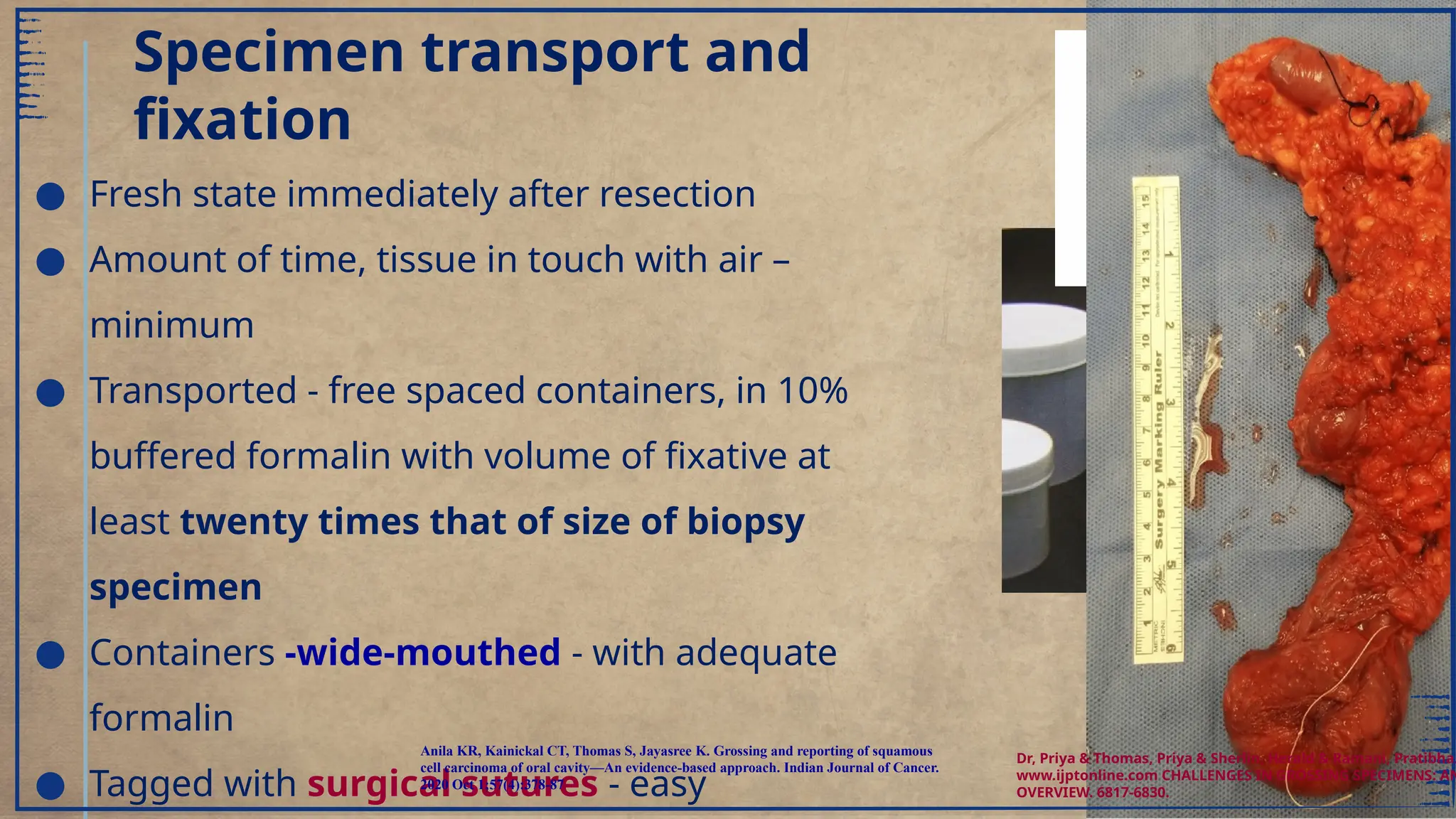 GROSSING PTNM journal club for MDS GRADUATES.... | PPTX