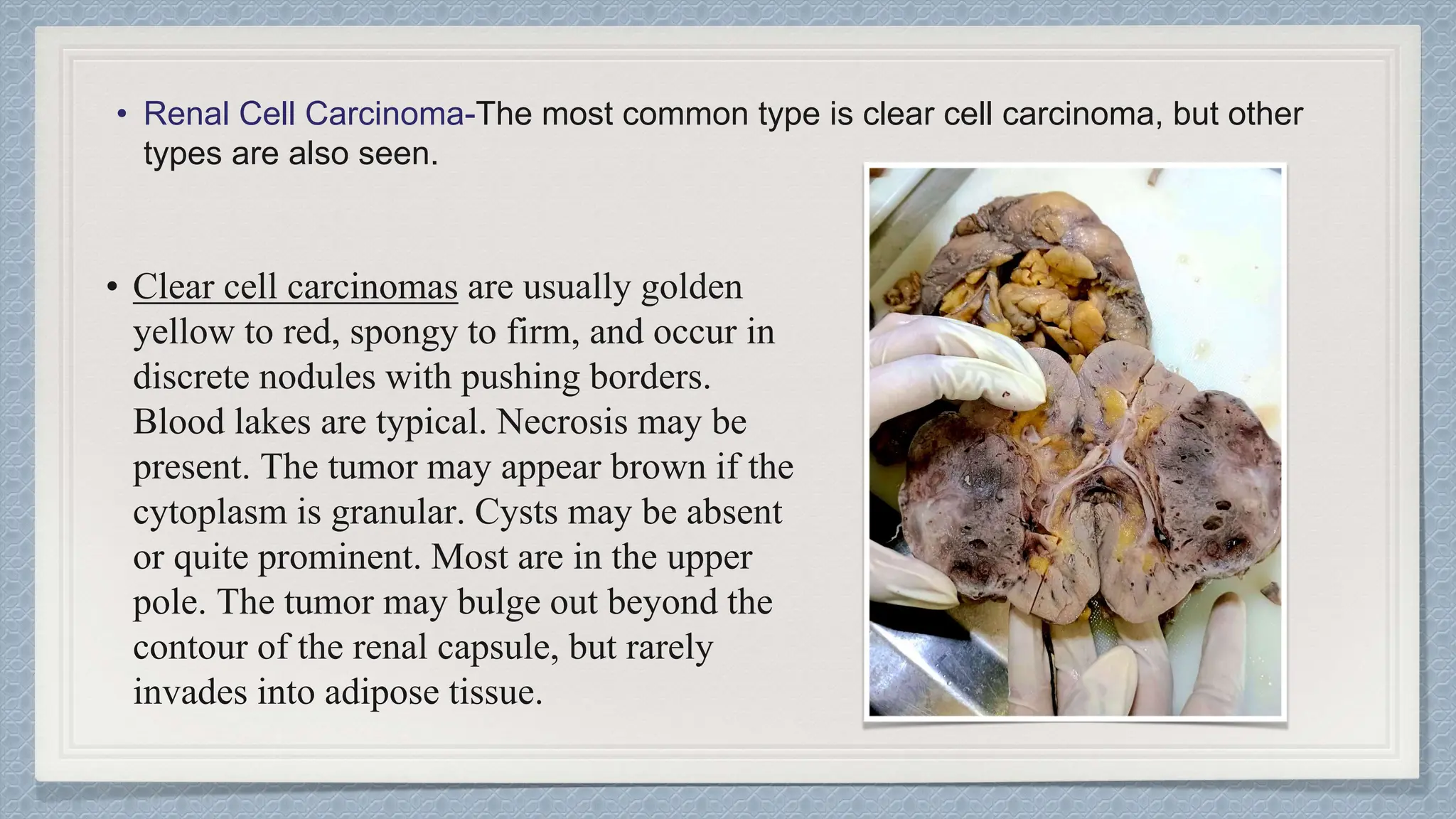 gross kidney methods for histology techniques.pptx