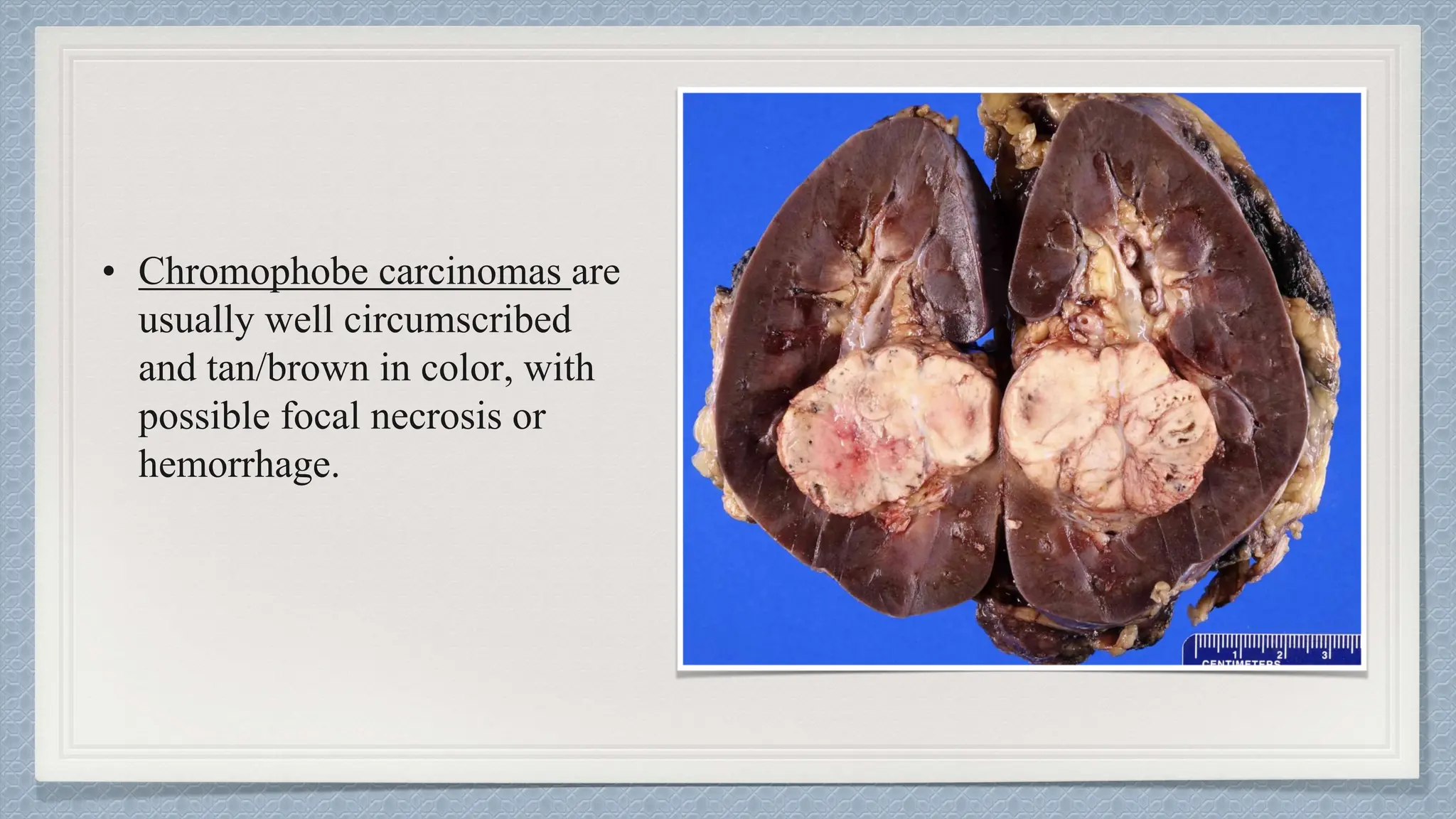 gross kidney methods for histology techniques.pptx