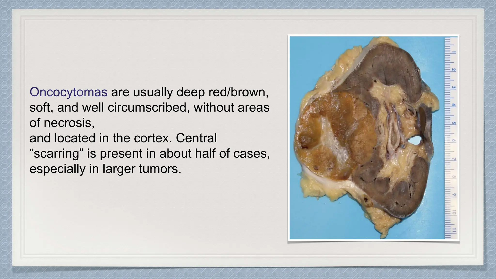 gross kidney methods for histology techniques.pptx