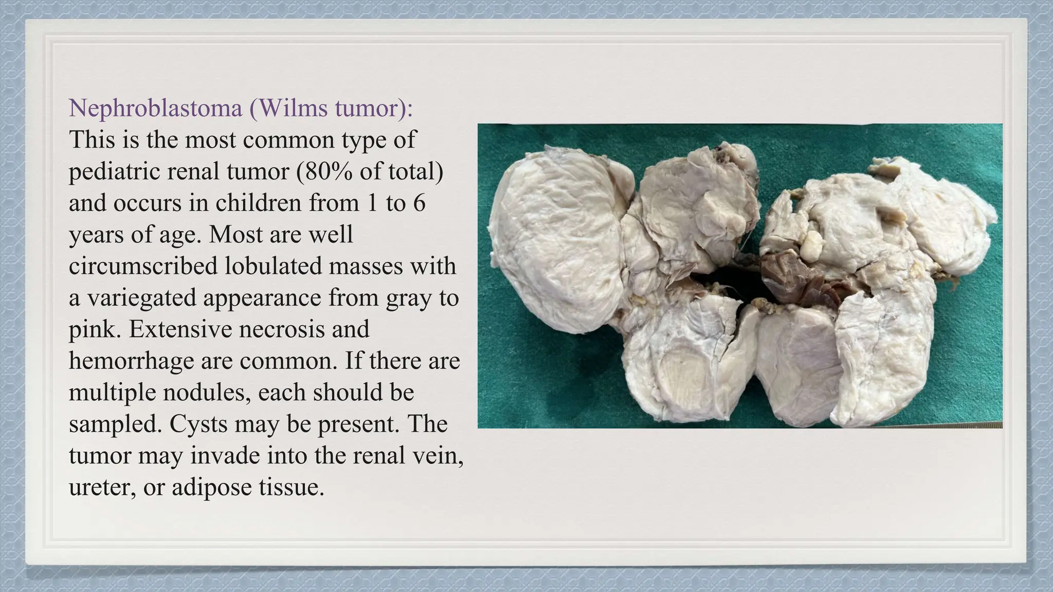 gross kidney methods for histology techniques.pptx