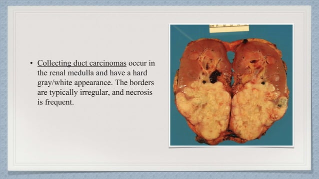 gross kidney methods for histology techniques.pptx | Endocrine and ...