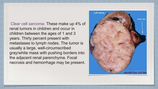 gross kidney methods for histology techniques.pptx | Endocrine and ...