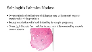 Gross & microscopy of FGT.pptx gross and micro | PPTX
