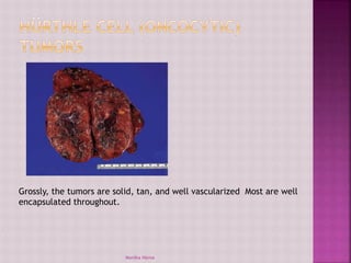 Gross of thyroid gland | PPTX