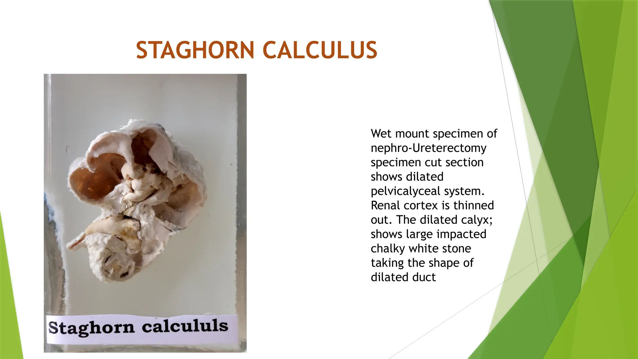 GROSS SPECIMEN REVISION UG pathology.pptx