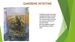 GROSS SPECIMEN REVISION UG pathology.pptx