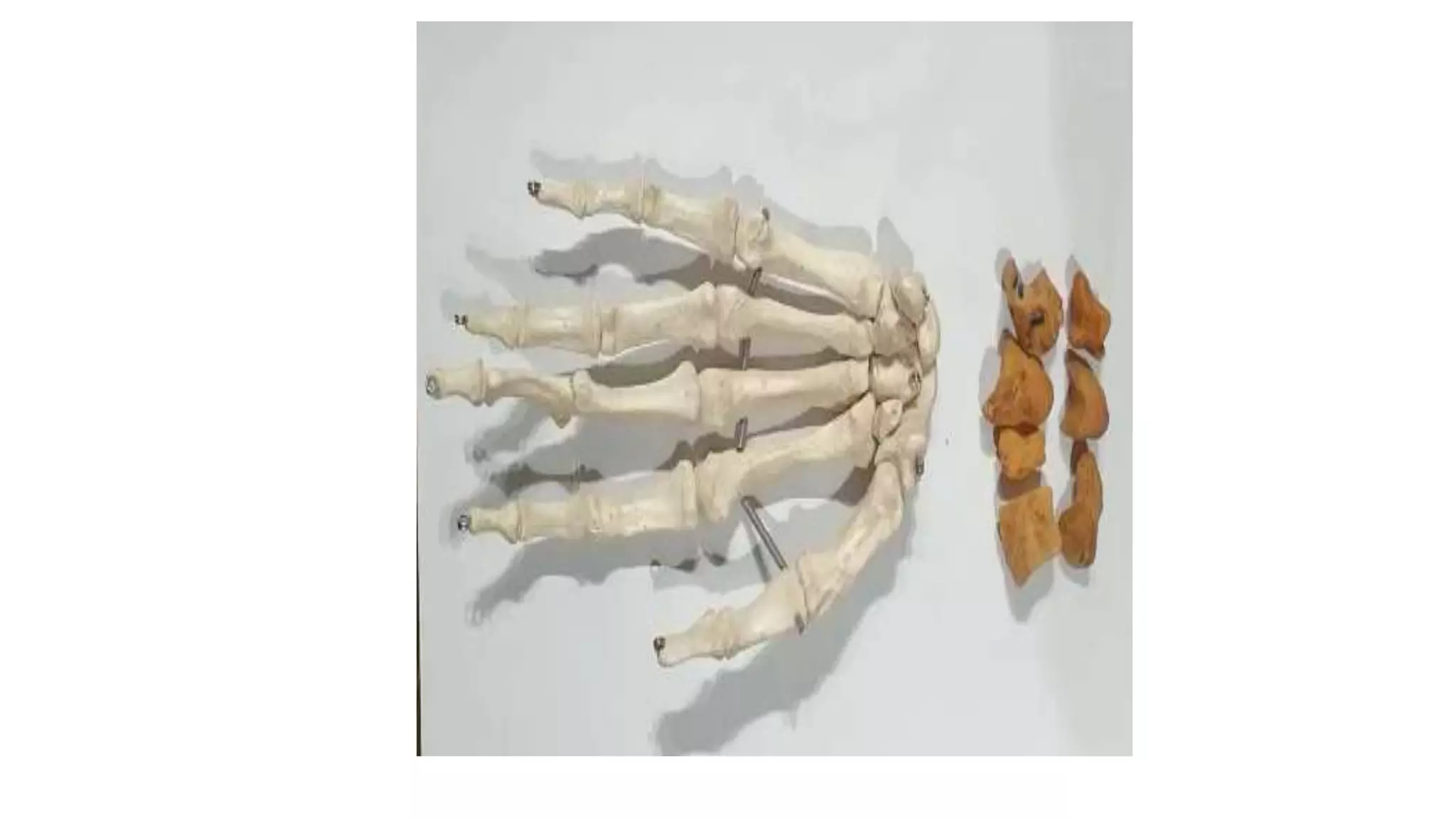 Gross Spotting Of Elbow Joint, Wrist,.pptx
