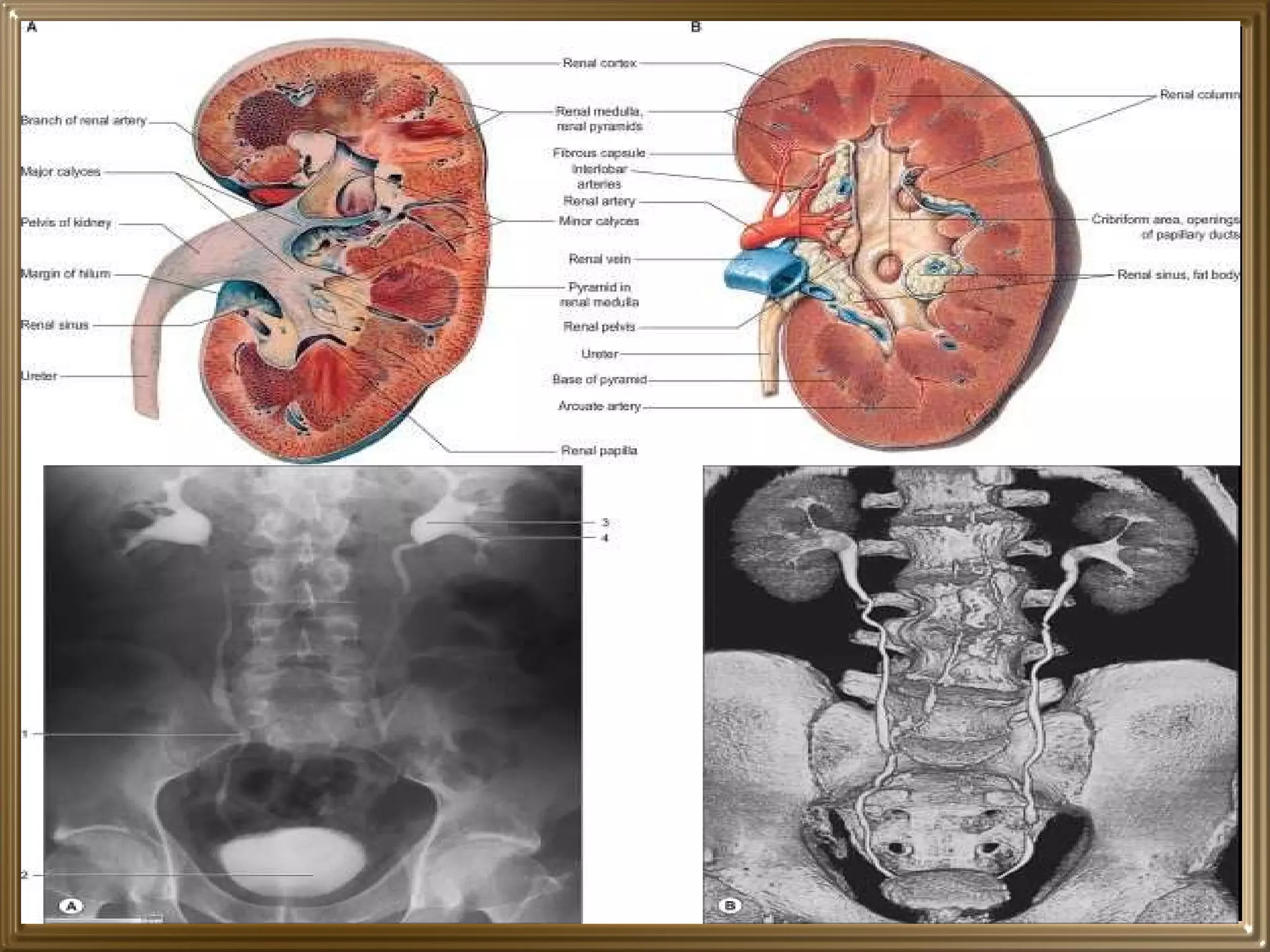 Gross structure of kidney and ureter | PPT