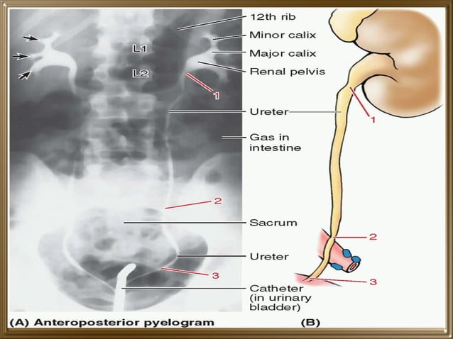 Gross structure of kidney and ureter | PPT