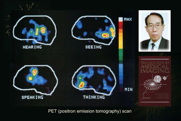 Gross structure of the brain | PPT | Brain and Nervous System Disorders ...