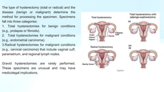 GROSS UTERUS with cervix and fallopian tube PPT.pptx