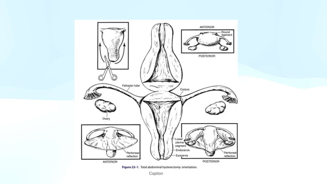 GROSS UTERUS with cervix and fallopian tube PPT.pptx