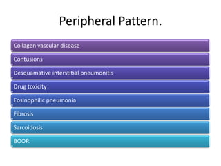 HRCT chest Ground glass opacities | PPTX