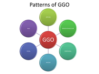 HRCT chest Ground glass opacities | PPTX