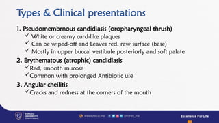 GROUP 1- FUNGAL INFECTIONS IN PAEDIATRIC DENTISTRY.pptx