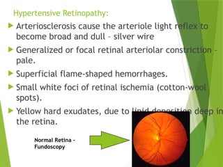 group 16 presentation of hypertension.pptx