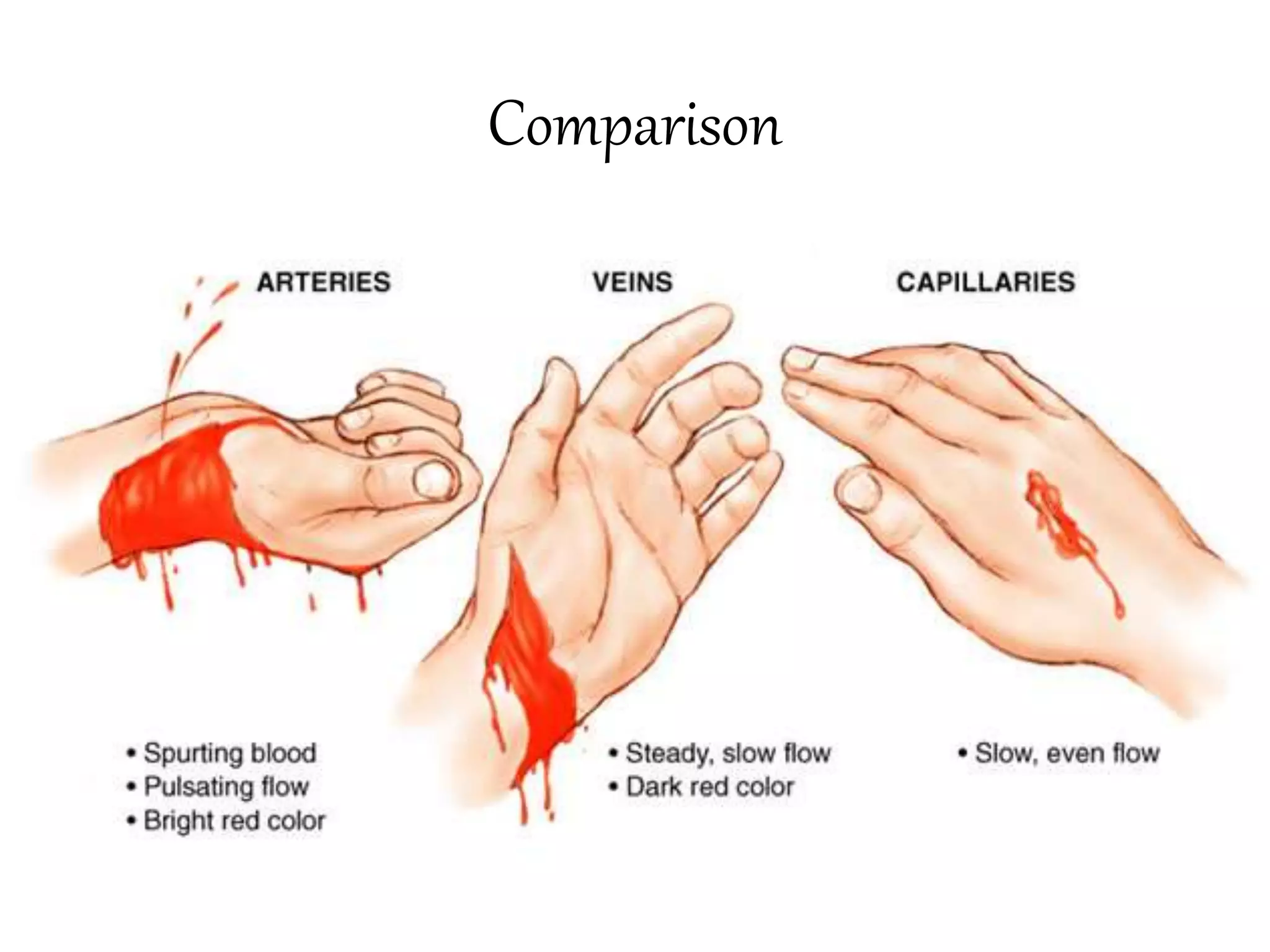 Basic First Aid (Bleeding) | PPTX