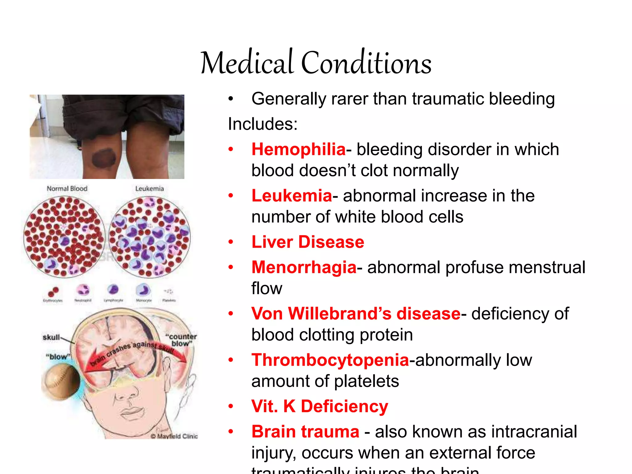 Basic First Aid (Bleeding) | PPTX