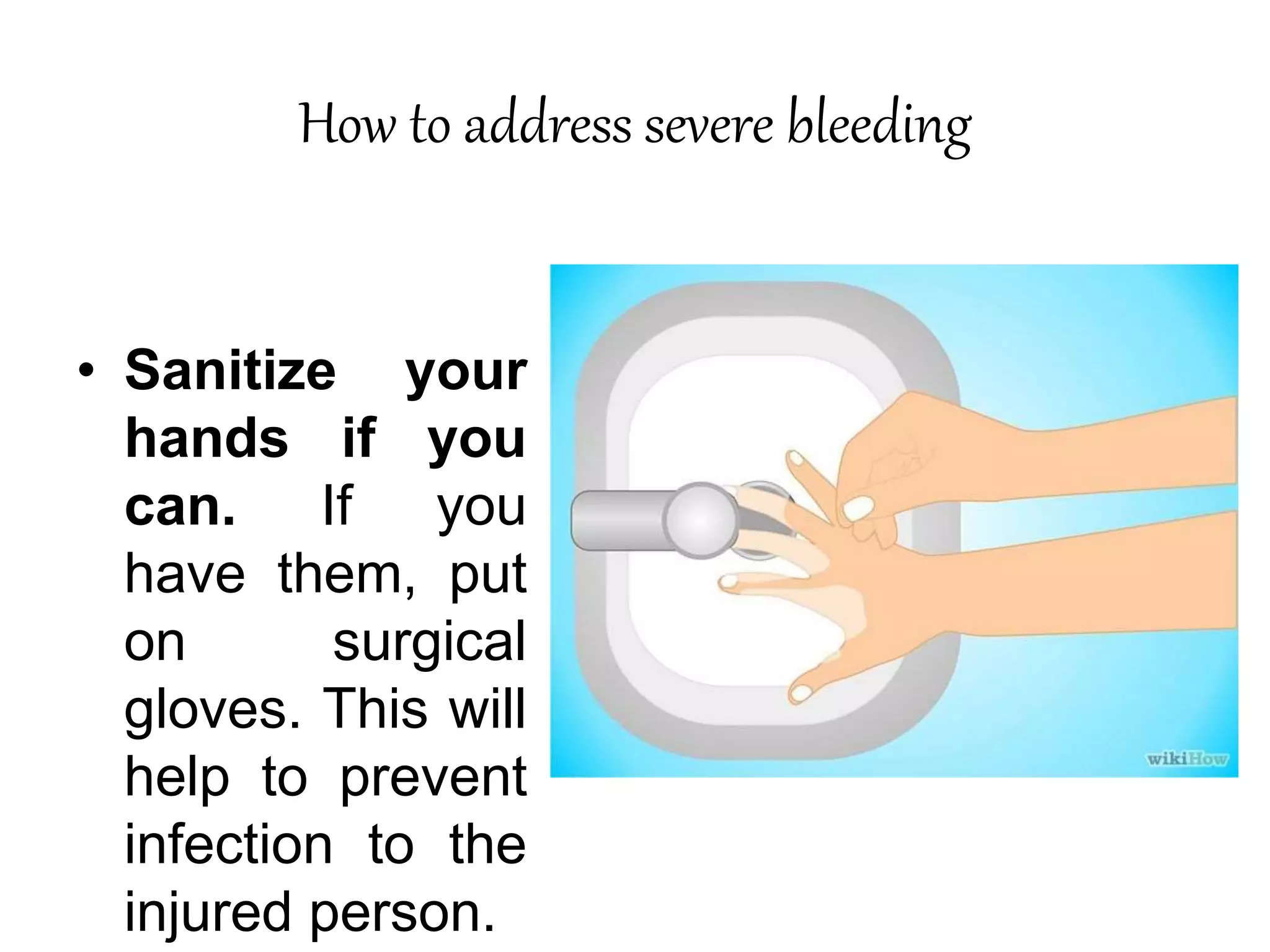 Basic First Aid (Bleeding) | PPTX