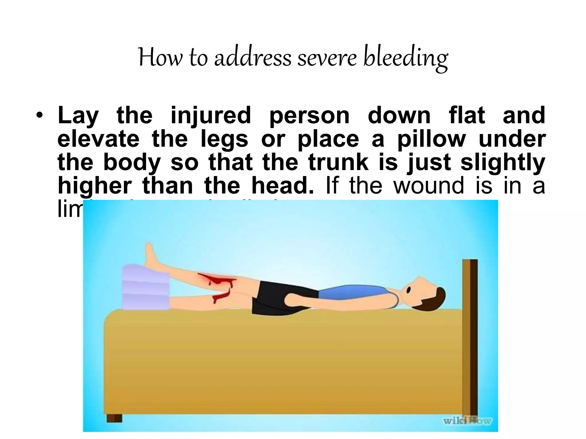 Basic First Aid (Bleeding) | PPTX