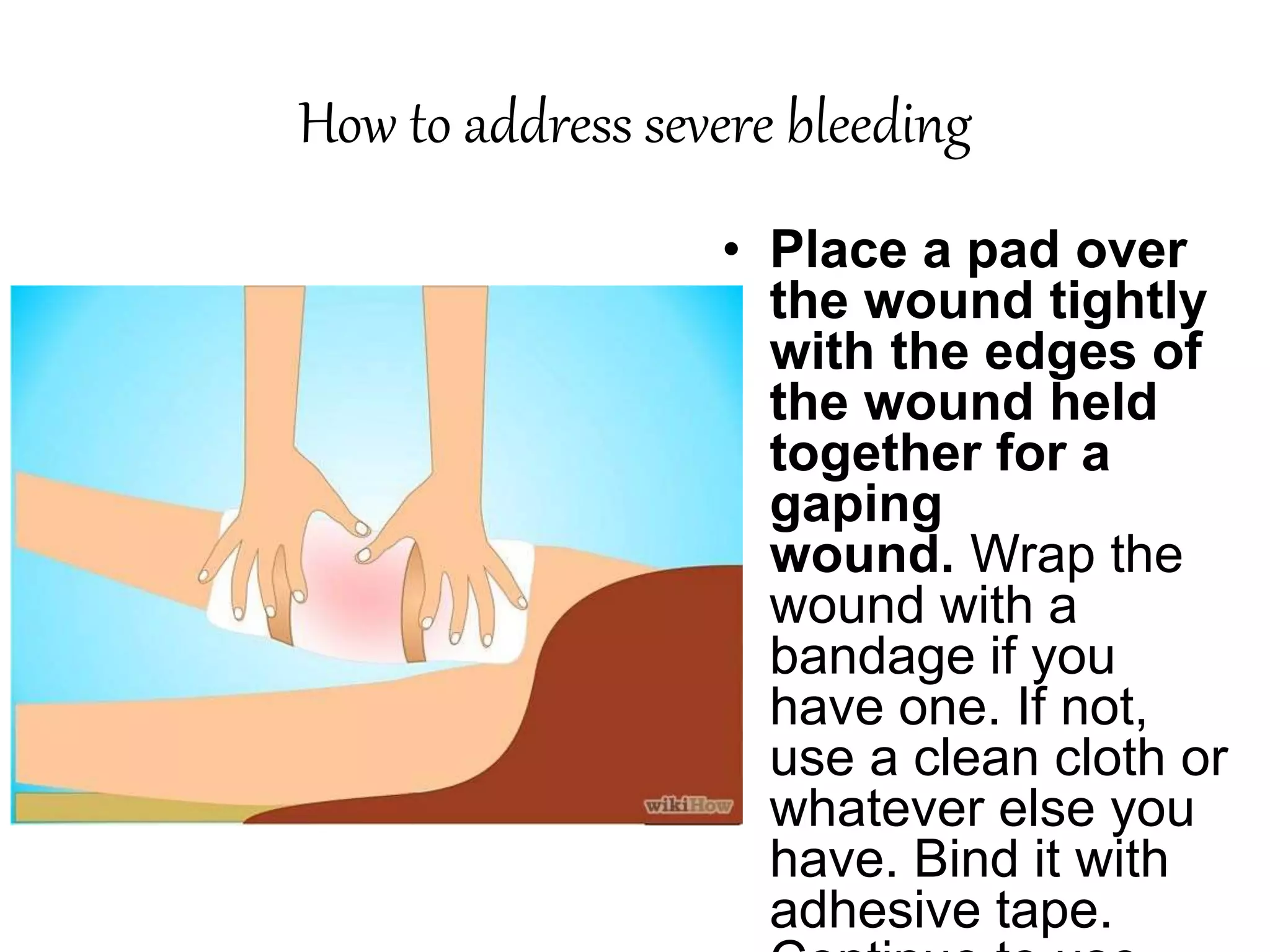 Basic First Aid (Bleeding) | PPTX