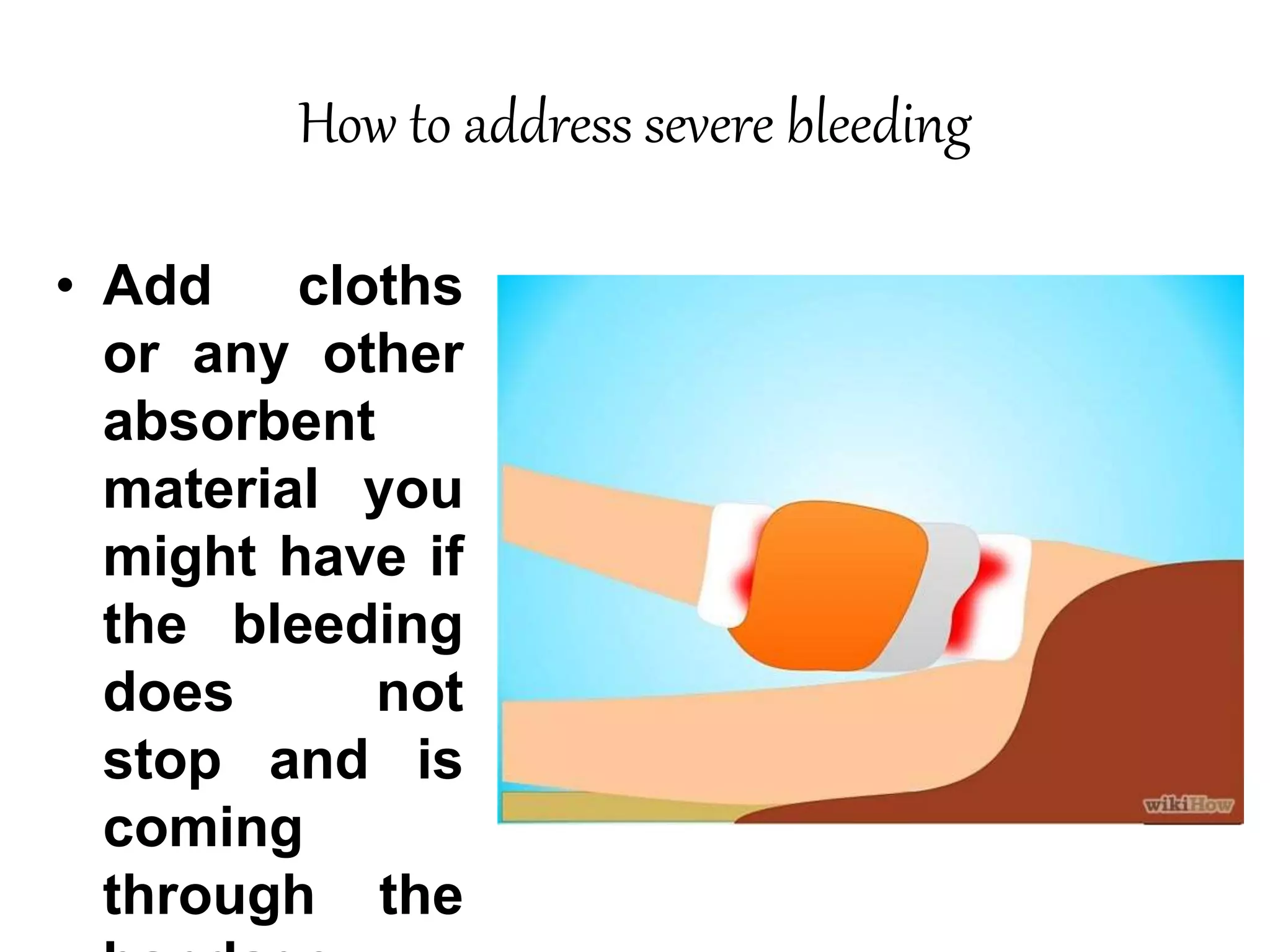 Basic First Aid (Bleeding) | PPTX