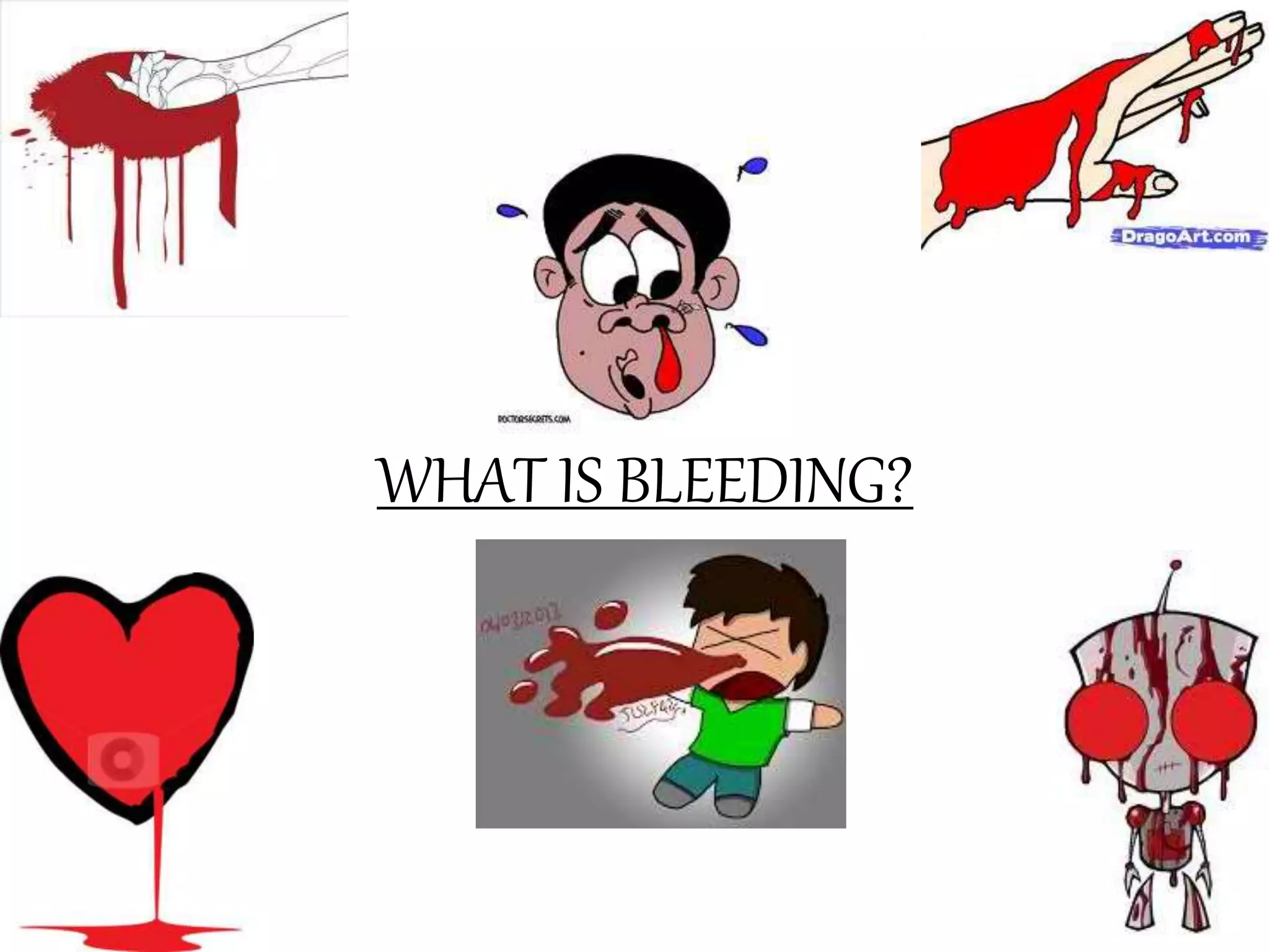 Basic First Aid (Bleeding) | PPTX
