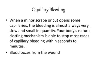 Basic First Aid (Bleeding) | PPTX