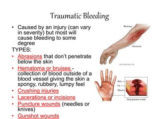 Basic First Aid (Bleeding) | PPTX
