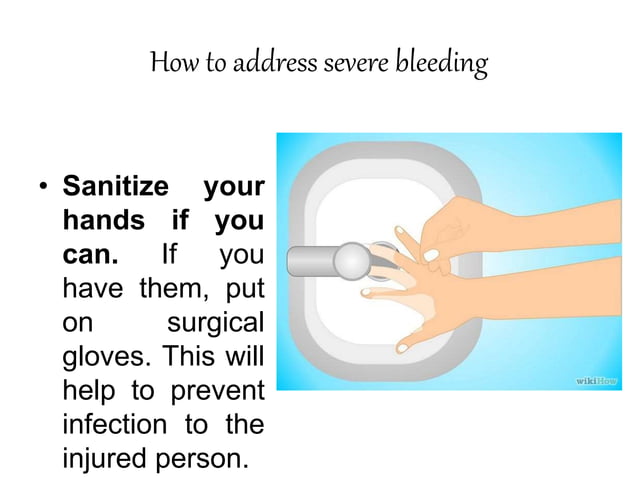 Basic First Aid (Bleeding) | PPTX