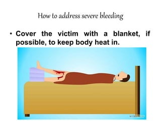 Basic First Aid (Bleeding) | PPTX