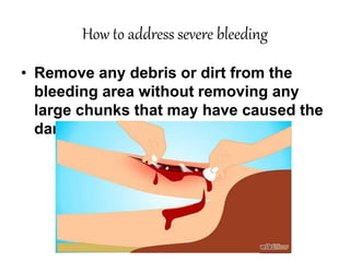 Basic First Aid (Bleeding) | PPTX