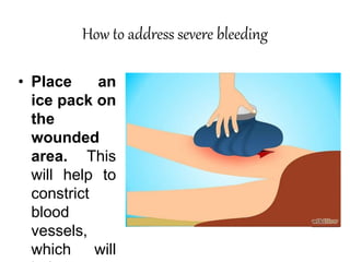 Basic First Aid (Bleeding) | PPTX