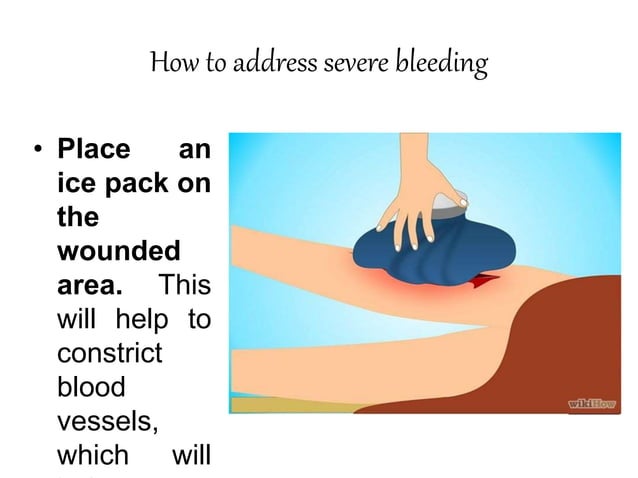 Basic First Aid (Bleeding) | PPTX