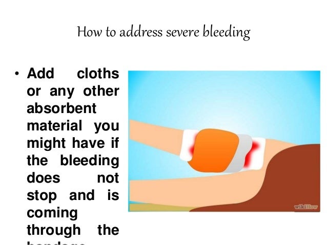 Basic First Aid (Bleeding)
