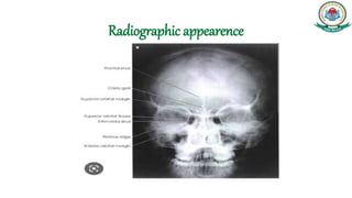 Group#1_caldwell view.pptx
