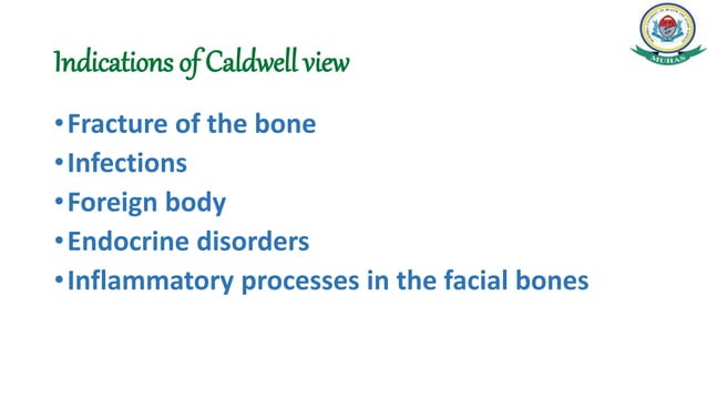 Group#1_caldwell view.pptx