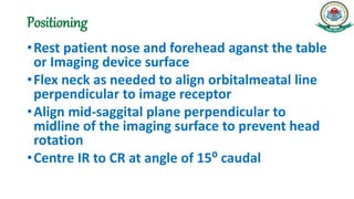 Group#1_caldwell view.pptx