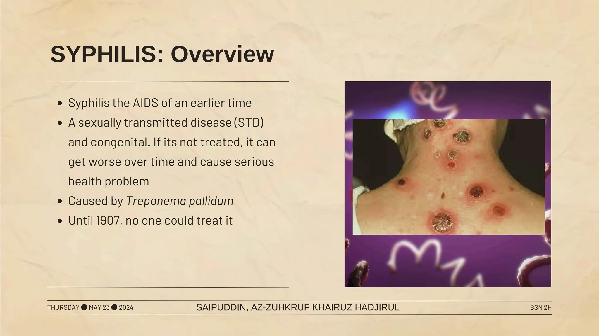 Group 1 Tuskegee Syphilis Study (1932-1972).pdf