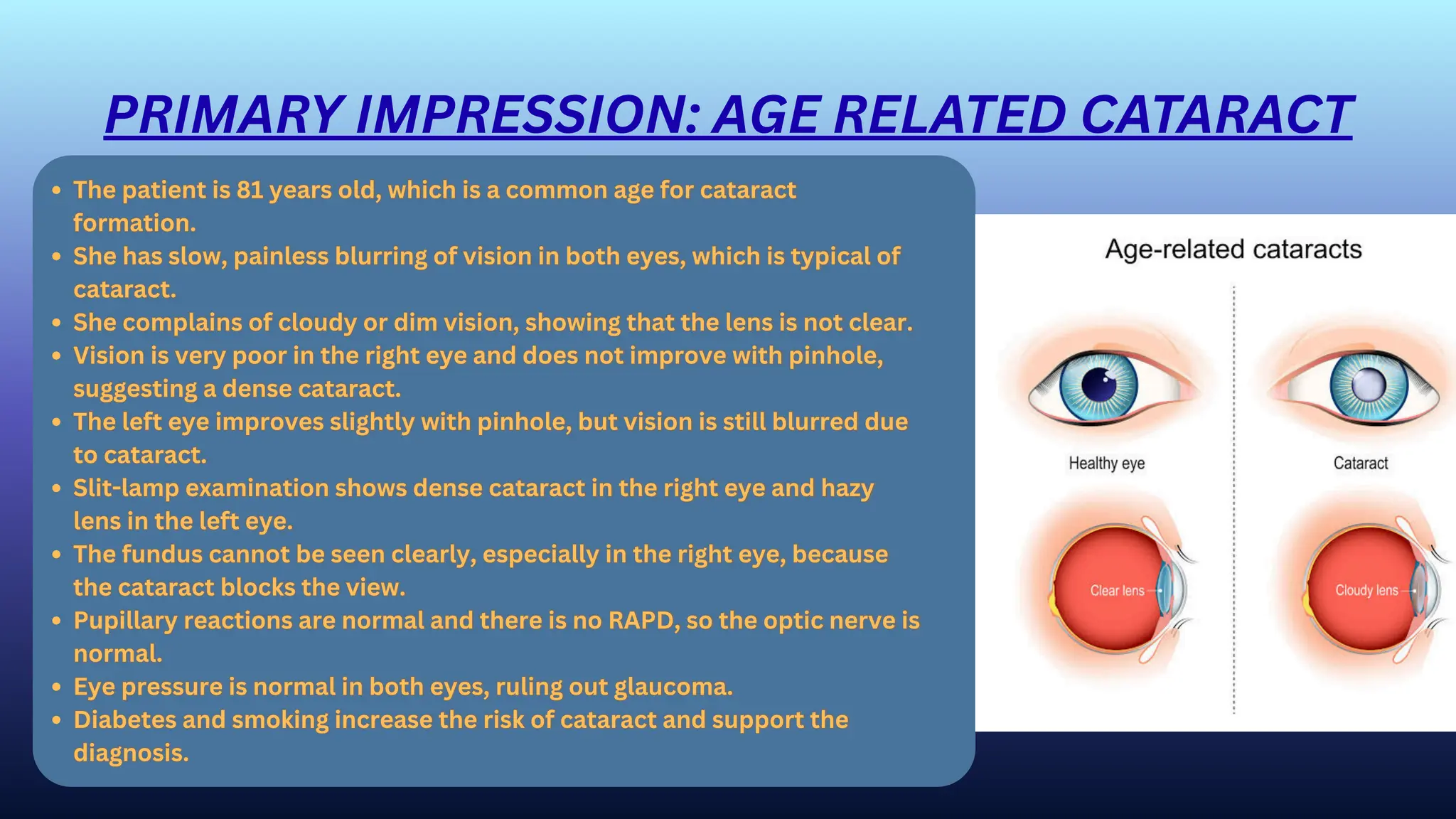Cataract presentation - age related cataract pdf | PDF