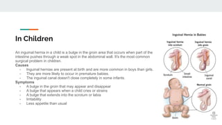group 2 the best.pdf hernia and inguinal hernia | PDF