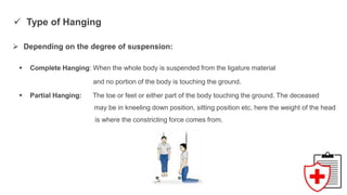 Hanging legal medicine | PPTX