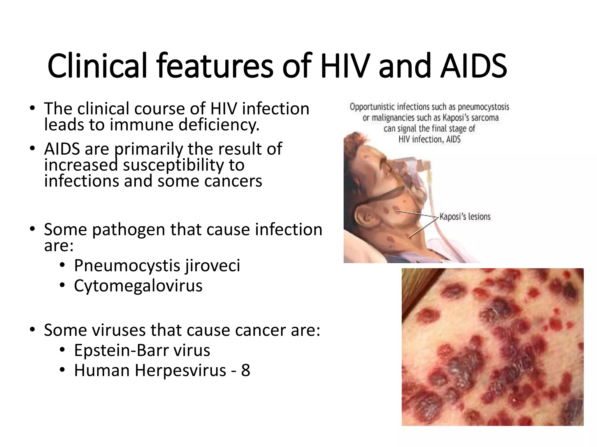 Congenital and Acquired Immunodeficiency | PPTX
